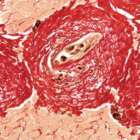 Picrosirius Red Stain Kit – Polysciences