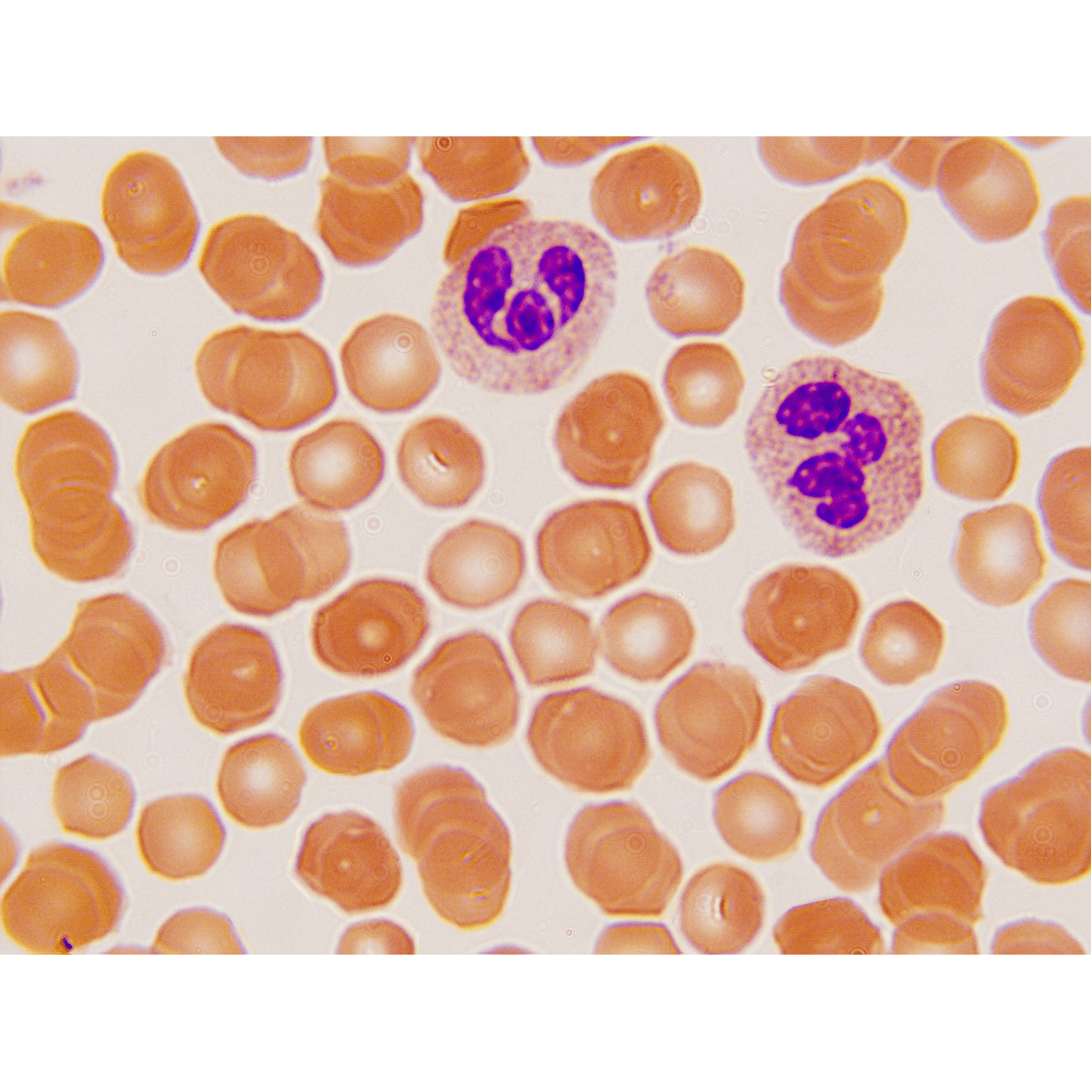 Differential Quik III Stain Kit – Polysciences