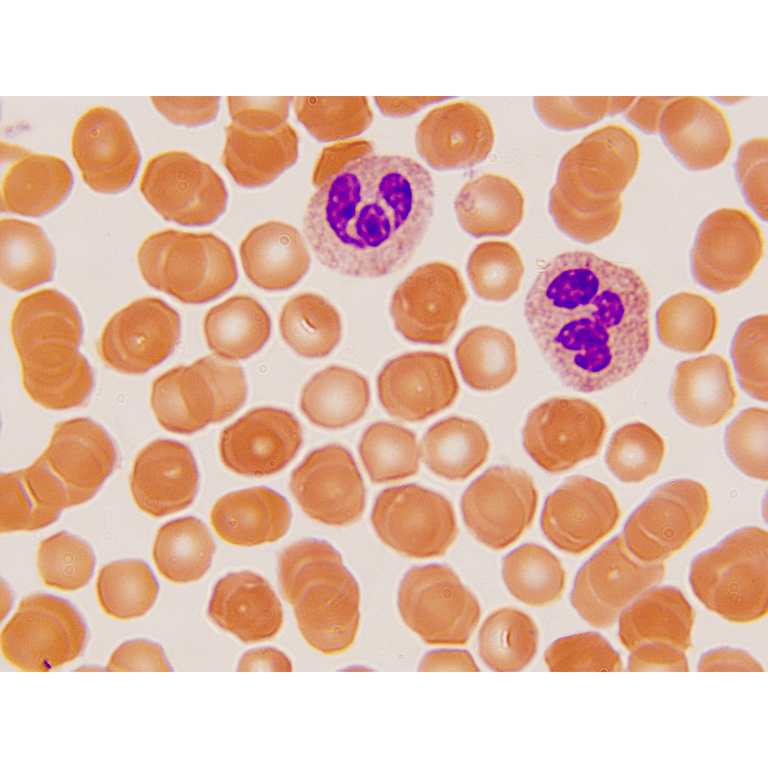 Differential Quik III Stain Kit – Polysciences